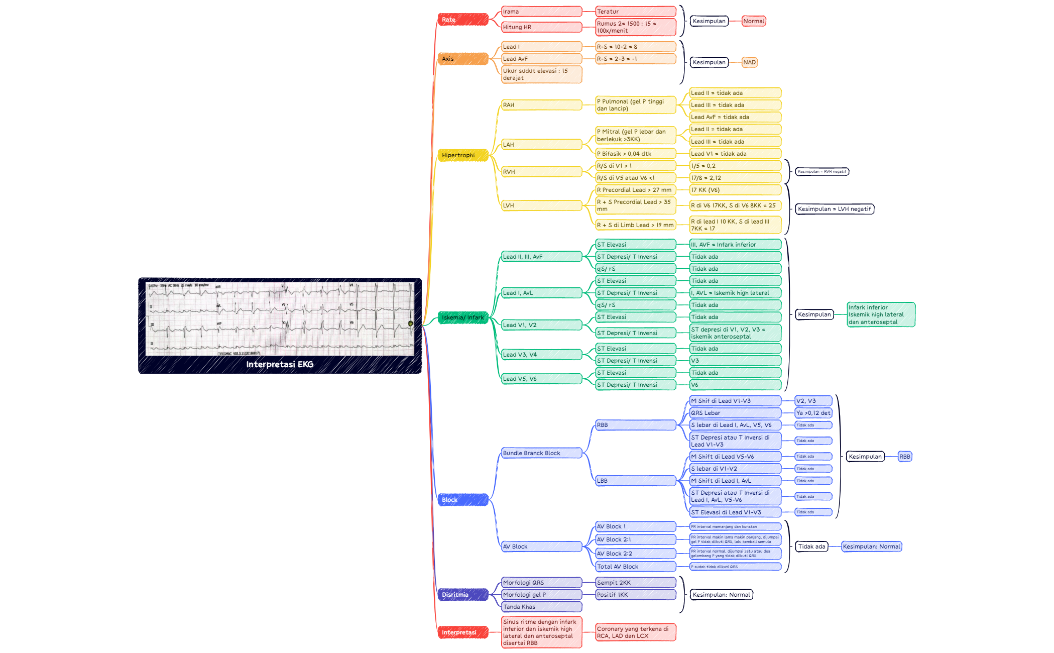 EKG BLOCK 2 - XMind Template