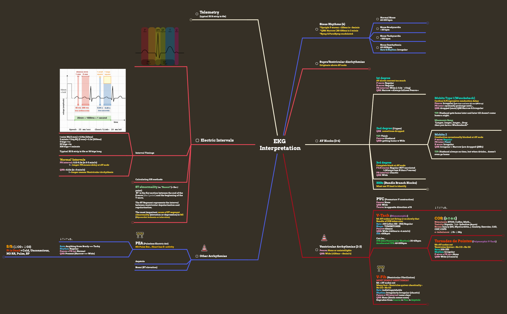 EKG Interpretation - XMind Template